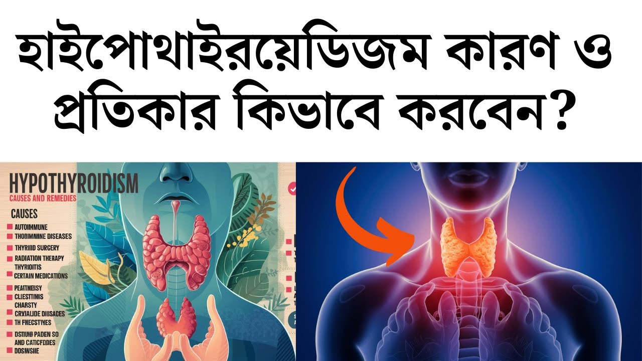 Hypothyroidism treatment medications, Thyroid problems - most common ...