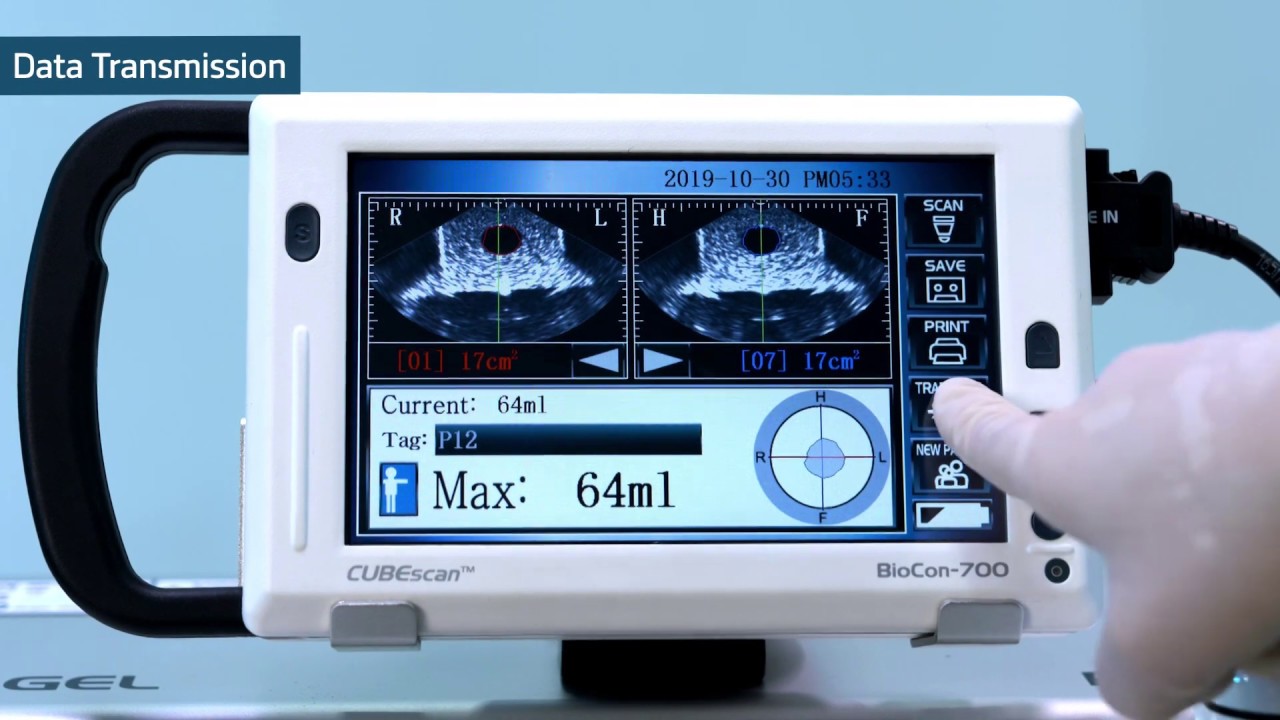 Product demonstration of BioCon-700_with new design probe module - YouTube