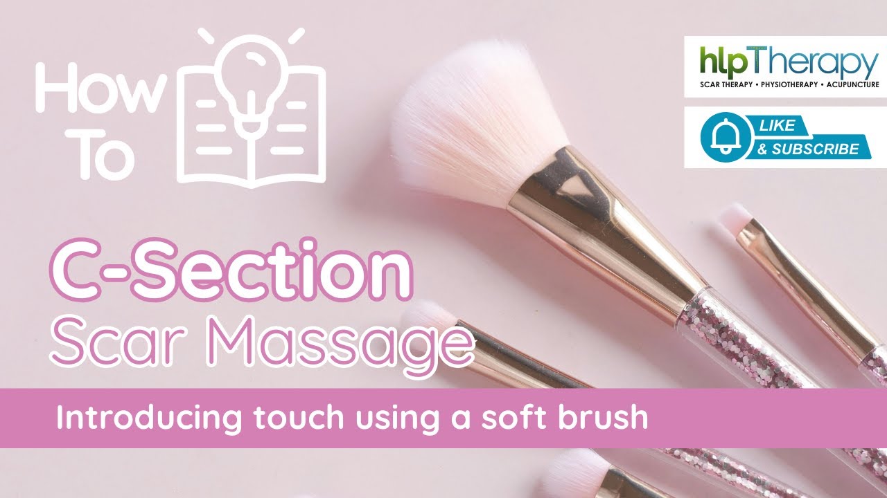 Scar Therapy | Techniques - Stroking with Brush | C-Section Scarring ...