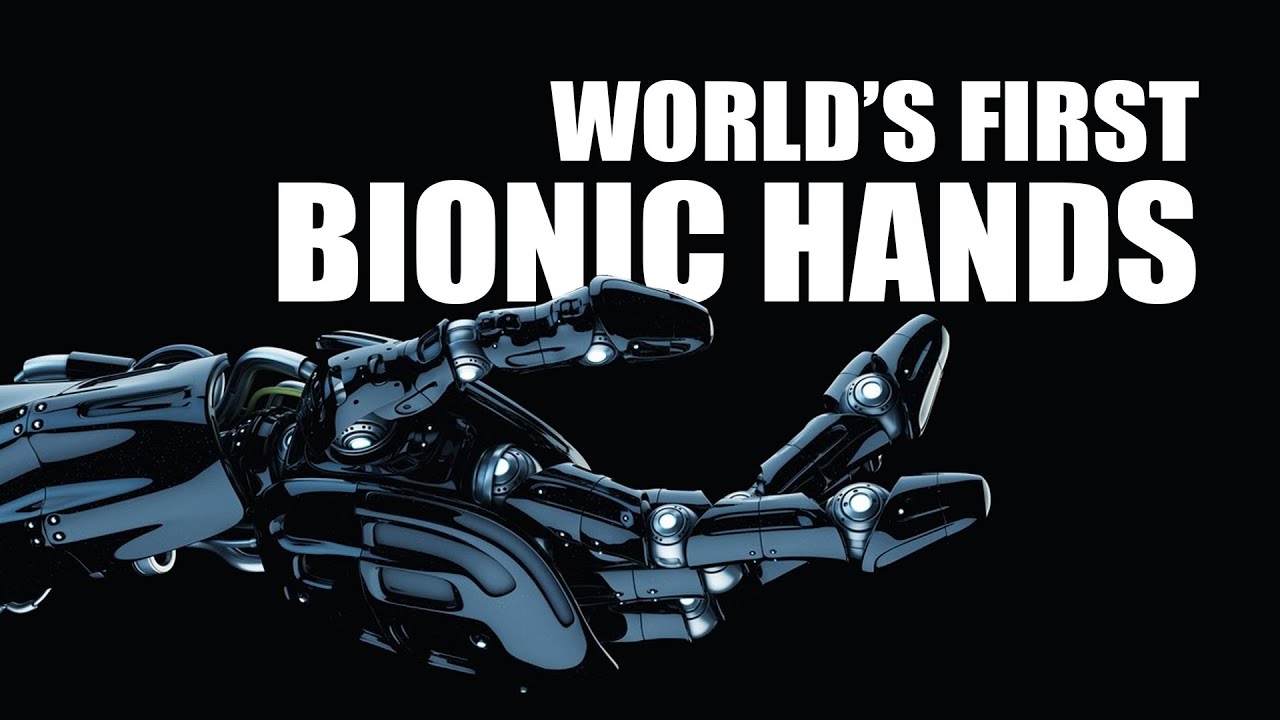 World's First Bionic Hands a Success! - The Know - YouTube