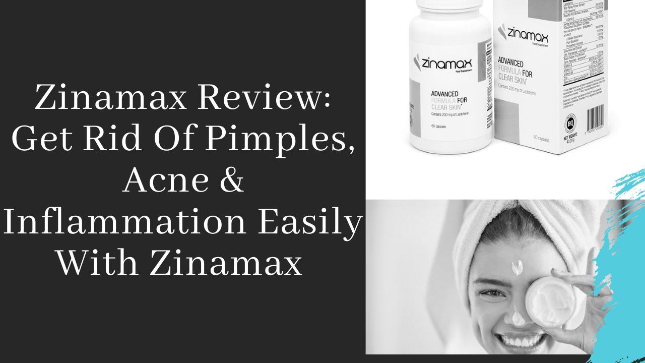 Zinamax Review: Get Rid Of Pimples & Acne With Zinamax - YouTube