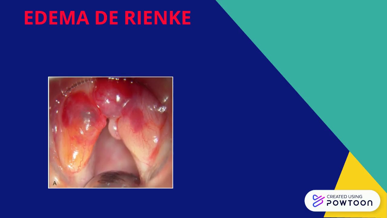prueba-2-youtube