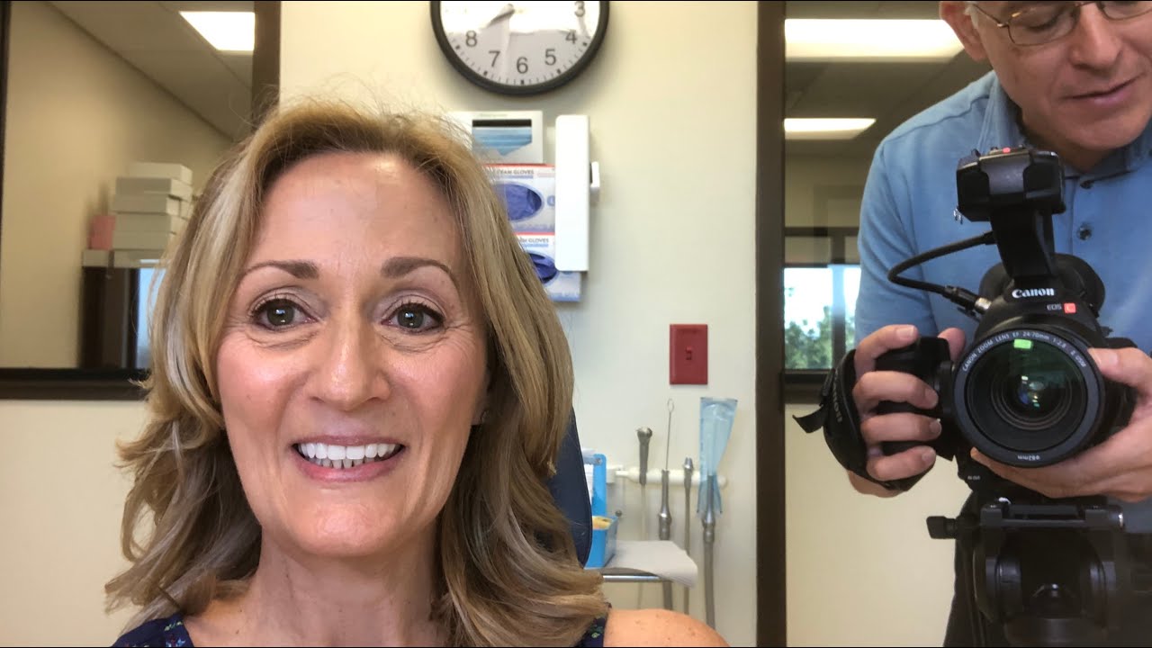 My Dental Journey Part 2 | Dental Implant Try Ons During Florida ...