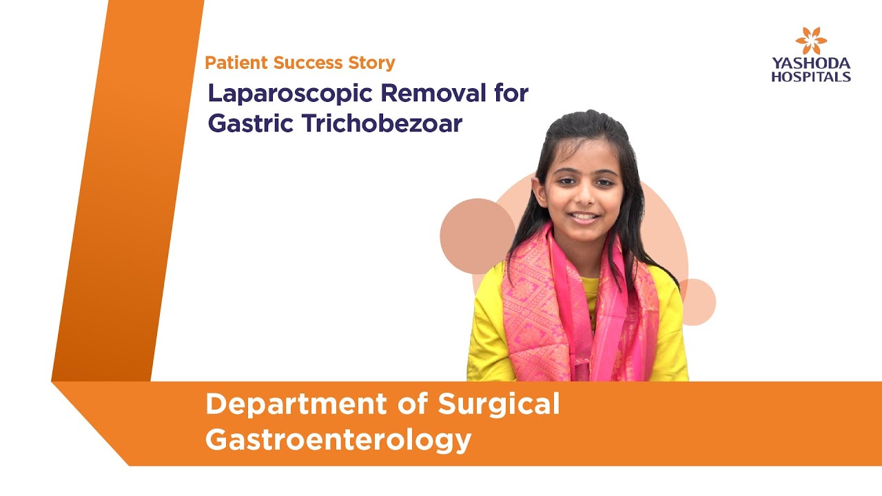Laparoscopic Removal for Gastric Trichobezoar | Yashoda Hospitals ...