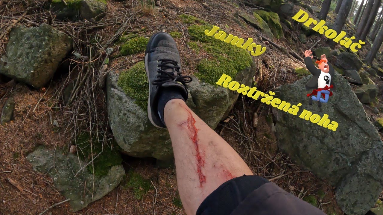 Roztržená noha, Drkoláč a Jamky - YouTube