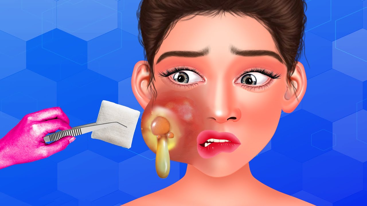 ASMR Treatment of bee sting wound on cheek | ASMR Animation - YouTube