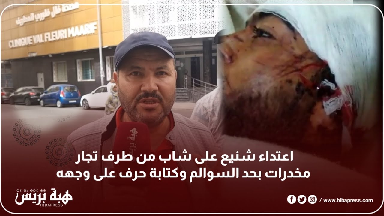 اعتد اء شنيع على شاب من طرف تجار مخدرات بحد السوالم وكتابة حرف على وجهه