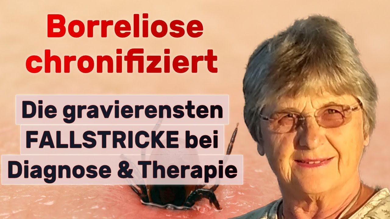 Borreliose: So vermeidest Du übliche Fehl-Diagnosen und Fehl-Behandlungen! Dr. Petra Hopf-Seidel ...