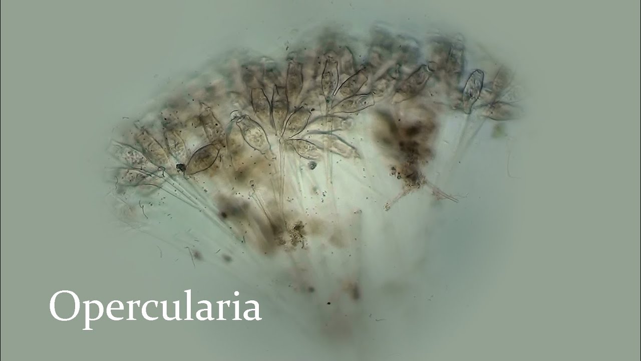 Opercularia - YouTube