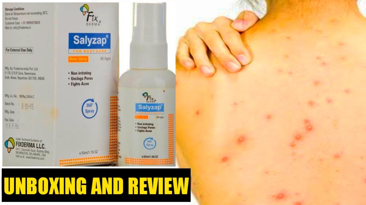 SALYZAP SPRAY | SALYZAP BODY SPRAY REVIEW | SALYZAP BODY SPRAY FOR BODY ...
