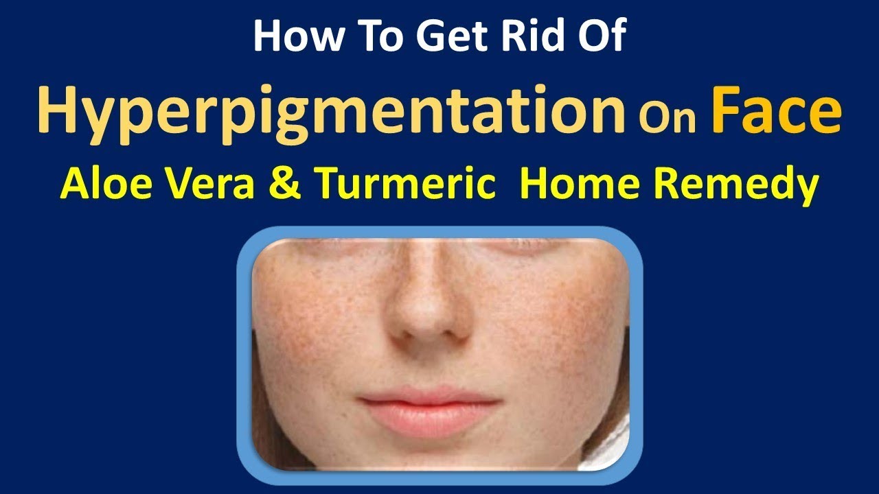 how to get rid of hyperpigmentation on face | Aloe Vera & Turmeric Home ...