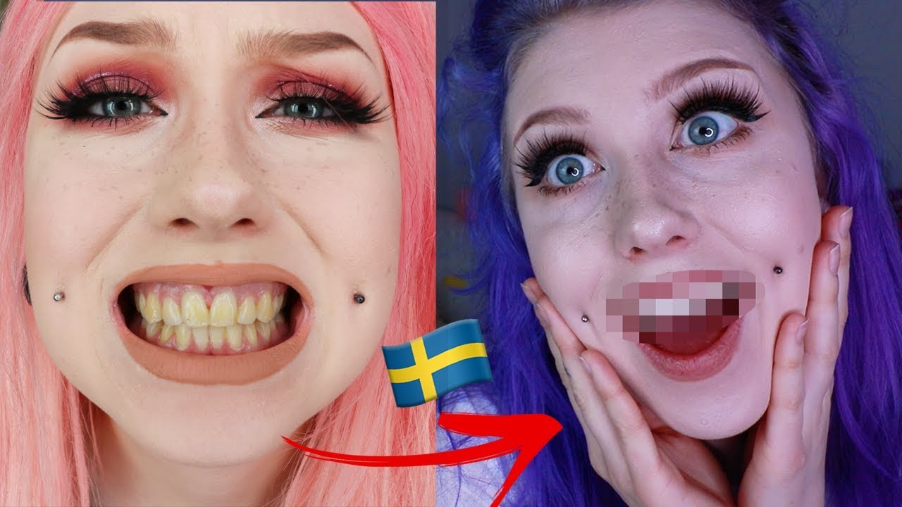 FROM SWEDISH TEETH TO WHITE┊ FIRST TIME WHITENING EVER - YouTube