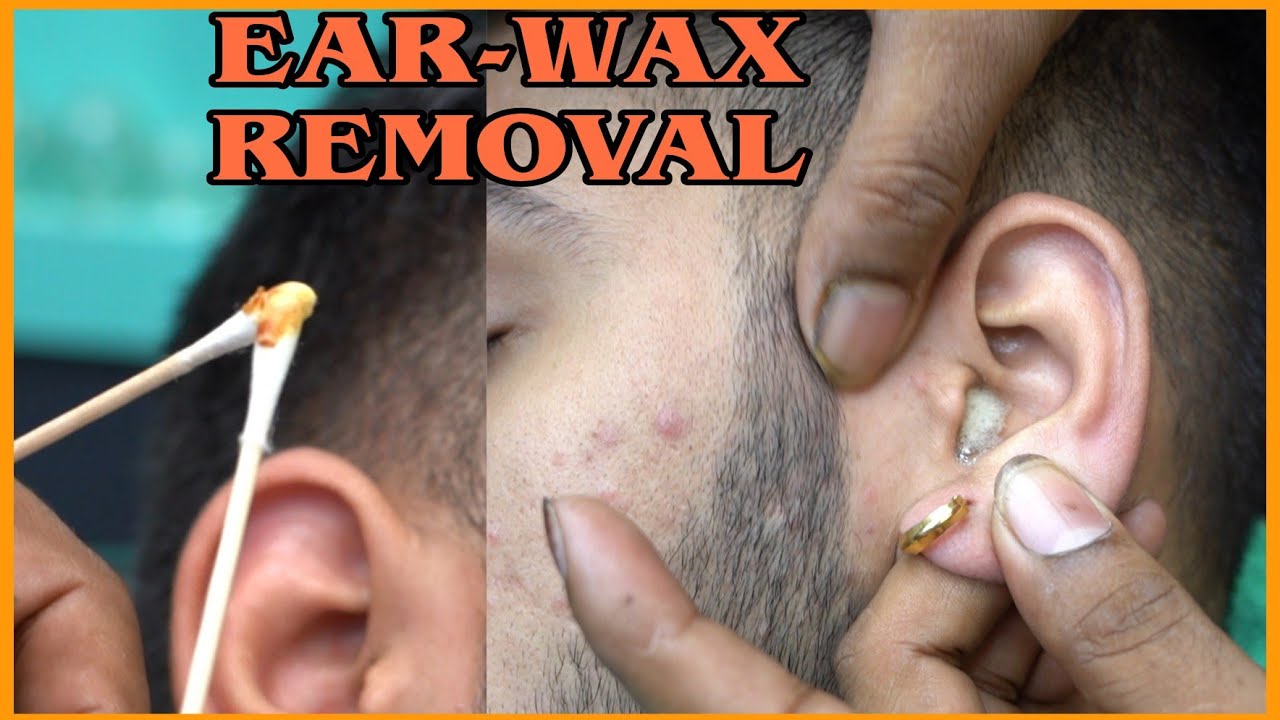 Insane amount of Dirty Ear Wax Removal and Ear Cleaning💈#asmr - YouTube