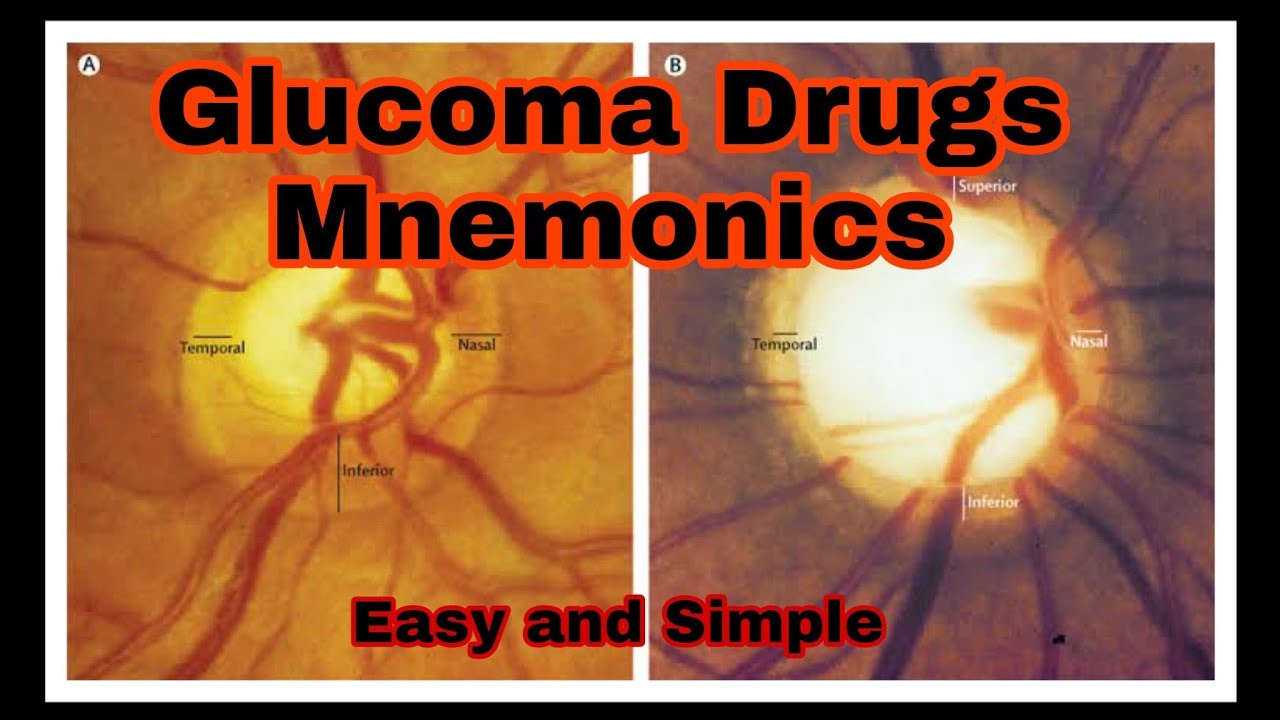Drugs for Glaucoma | Classification |Mnemonics | Antiglaucoma drugs ...