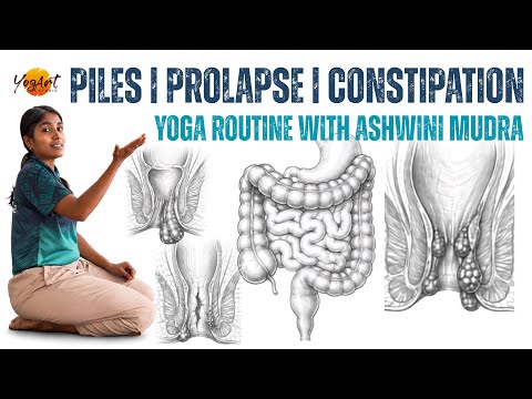 Yoga for Piles, Constipation & Prolapse with Ashwini Mudra | YogArt 