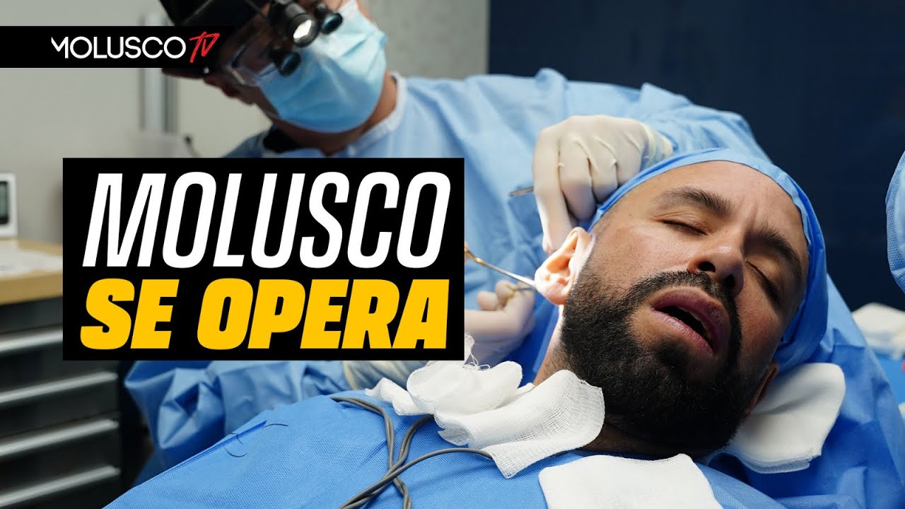 Molusco se juega la vida en el quirófano. OPERACION COMPLETA - YouTube