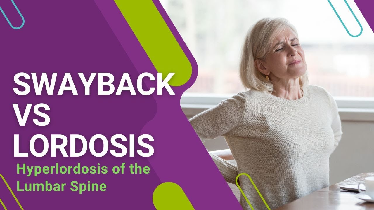 Swayback vs Lordosis: Hyperlordosis of the Lumbar Spine - YouTube