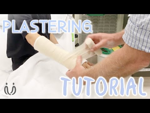 Plastering Tutorial for the Emergency Department: Colles Fracture - YouTube