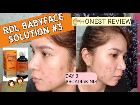 RDL BABYFACE SOLUTION #3 (DAY 3) |HONEST REVIEW |ROAD TO KINIS - YouTube