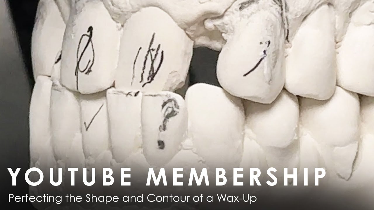 Perfecting the Shape and Contour of a Wax-Up - YouTube