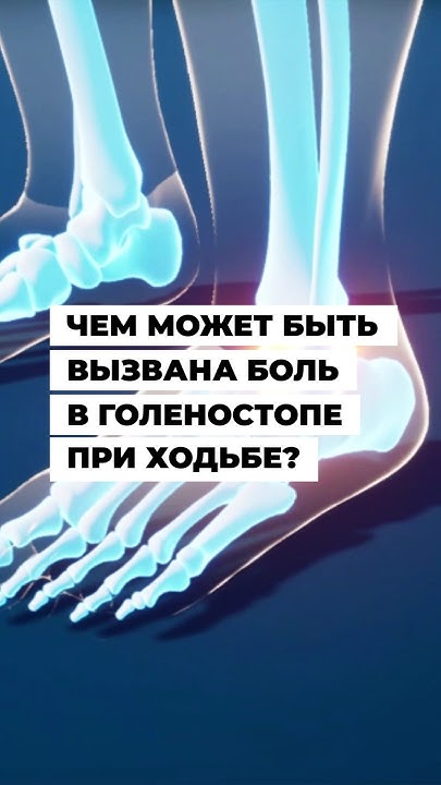 Боль в голеностопе: от чего? #больвголеностопе #болитголеностоп # ...