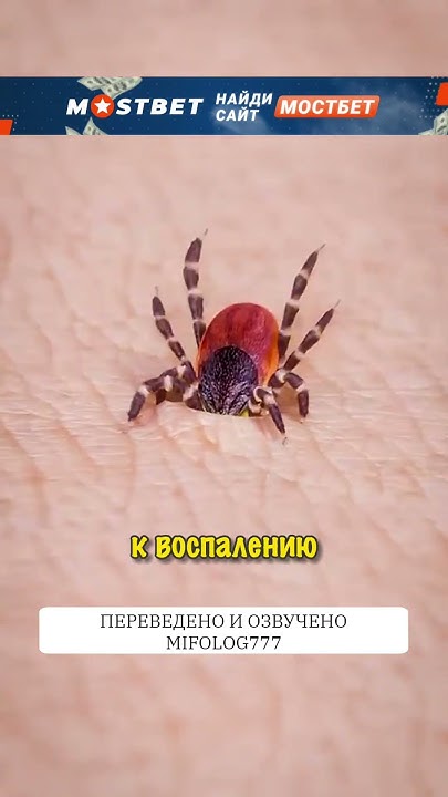 Как вытащить клеща 🤢 (📸zackdfilms) - YouTube