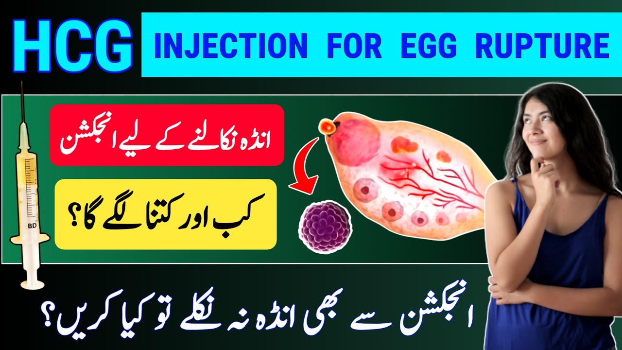 How To Get Pregnant in 1 Month With HCG Injection| HCG Injection For Ovulation/Egg Rupture |Dr ...