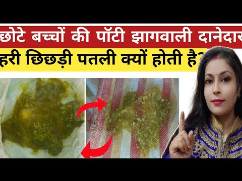 बच्चों में झाग, दही, हरी और पानी वाली potty का कारण और उपाय।। जाने doctor की सलाह।। #jhaagwalipotty