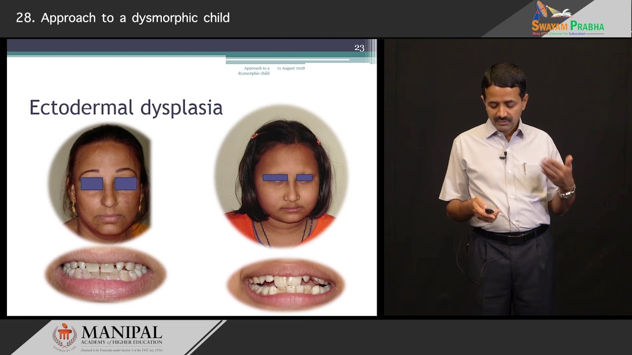 Approach to a dysmorphic child - YouTube
