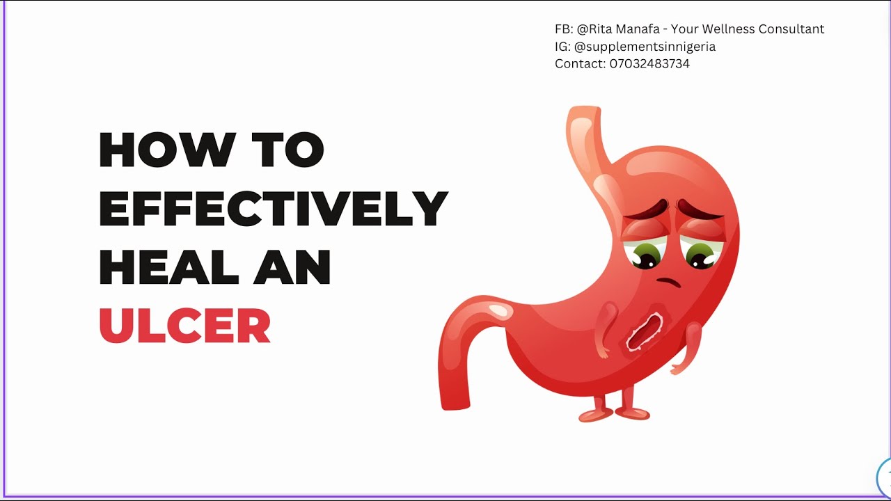 HOW TO EFFECTIVELY HEAL AN ULCER - YouTube