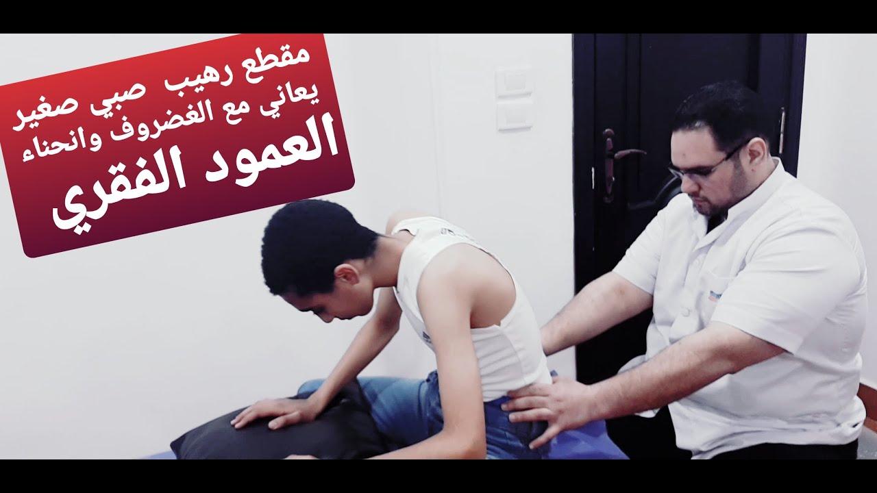 علاج صبى صغير يعانى من انحناء فى العمود الفقرى وديسك Youtube