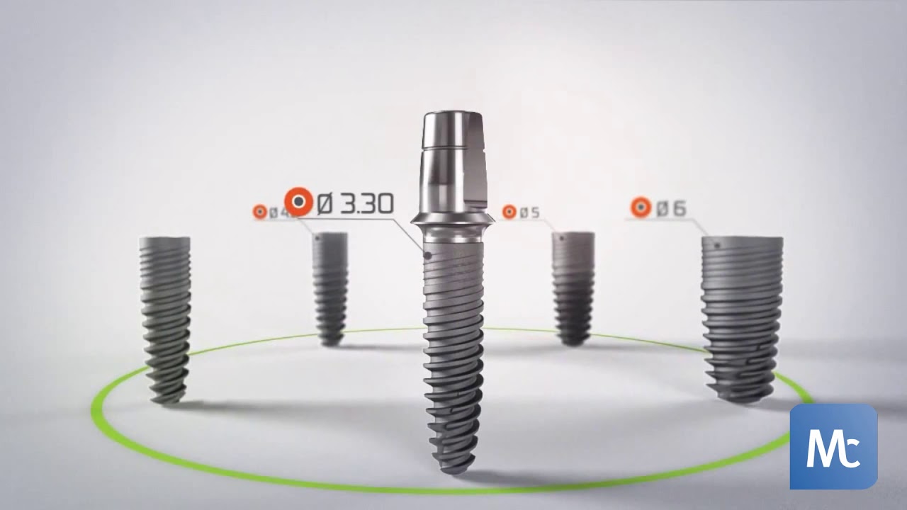 Implantes TAG Dental - YouTube