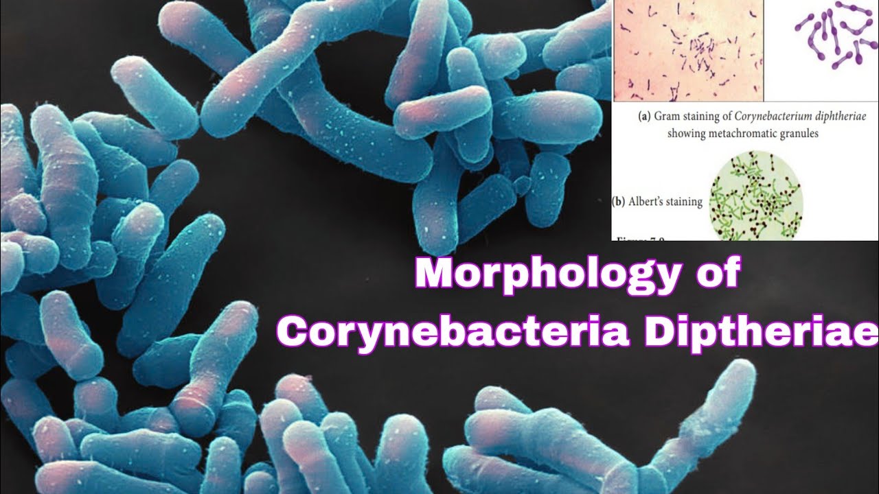 Morphology of Corynebacteria Diptheriae - YouTube