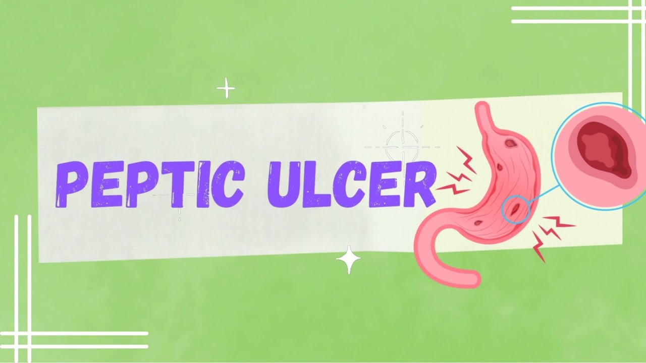 Peptic ulcer disease // English animation - YouTube