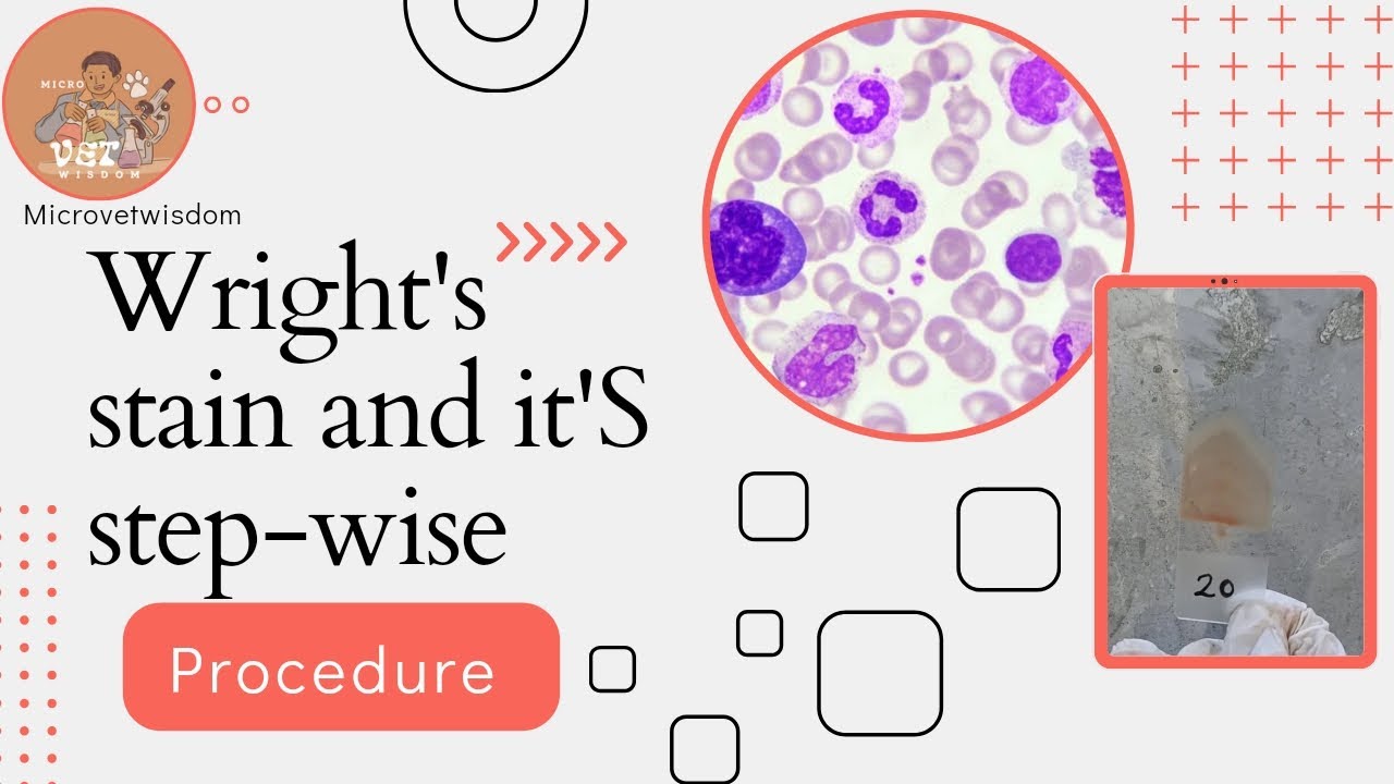 "Wright's Stain Procedure Explained: Step-by-Step Guide for Beginners ...