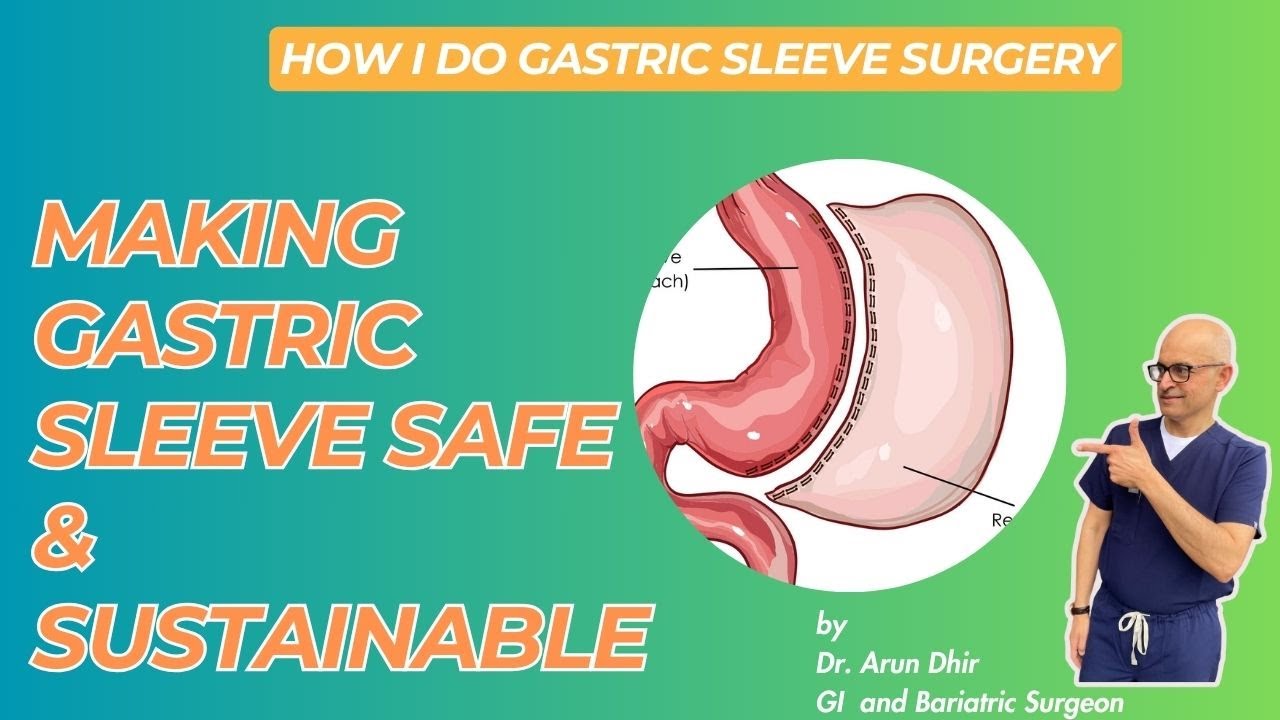 Surgical Technique : How I Do Gastric Sleeve Surgery to Make it ...