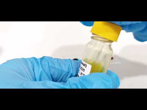 Forward Blood Typing Slide Method Procedure | MEDICAL LABORATORY ...