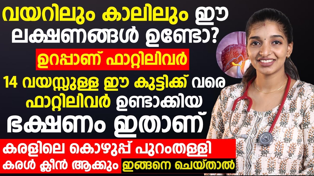 കുട്ടികൾക്ക് വരെ ഫാറ്റിലിവറിനു കാരണം ഈഭക്ഷണമാണ്ഈ ലക്ഷണം ഉണ്ടോ എന്ന് ഇപ്പോൾ തന്നെ നോക്കുfatty