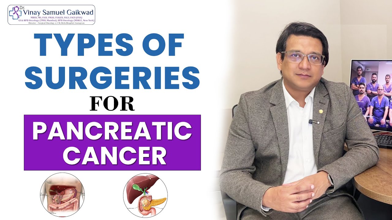 Types of Surgeries for Pancreatic Cancer by Dr. Vinay Samuel Gaikwad # ...