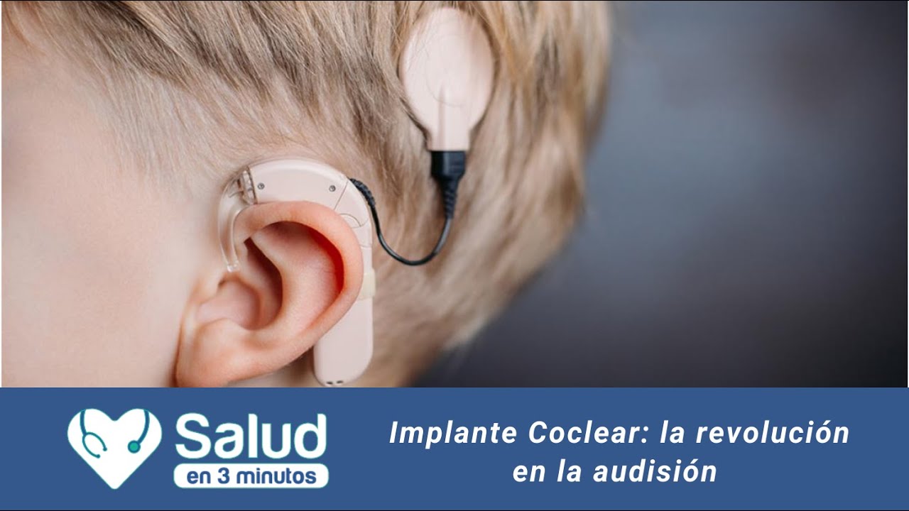 IMPLANTE COCLEAR: Una mágica solución auditiva - YouTube
