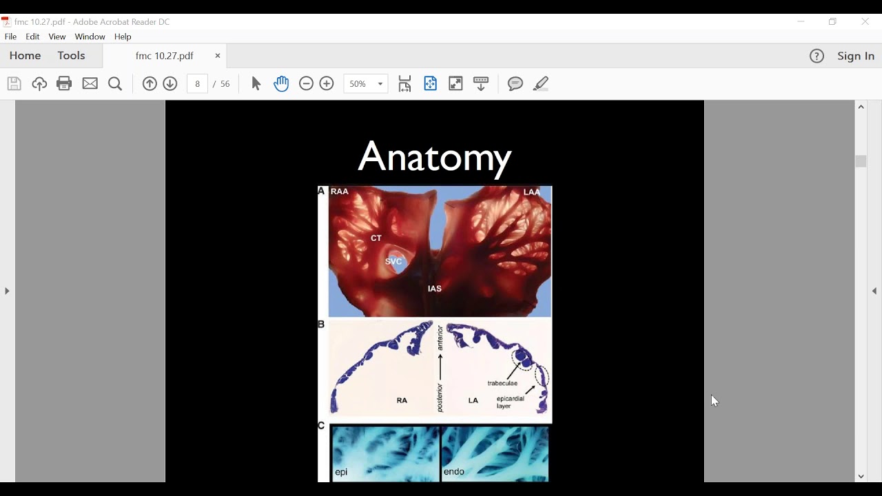 Percutaneous Interventions for Cardioembolic Stroke; Simone Musco, MD ...