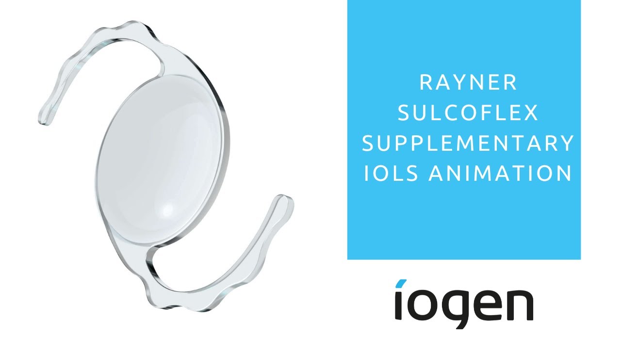 Rayner Sulcoflex Supplementary IOLs Animation - YouTube