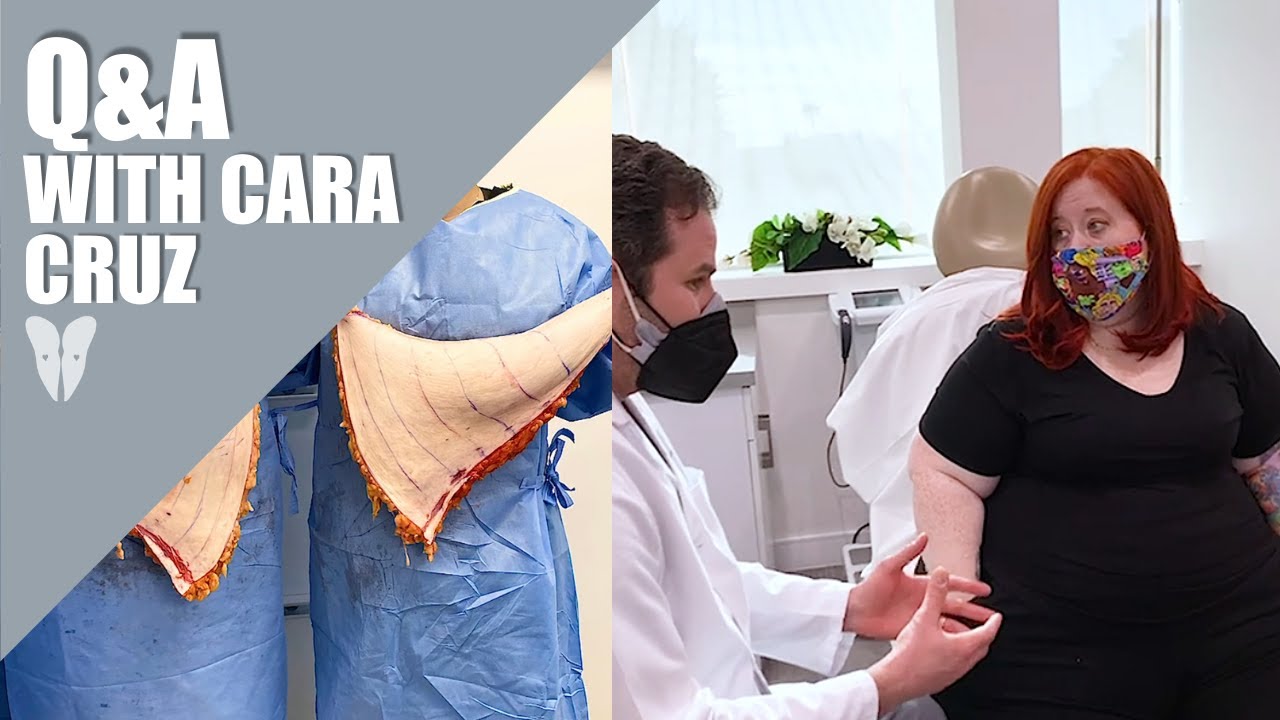 Live with Cara Cruz | Lipedema Surgery - YouTube