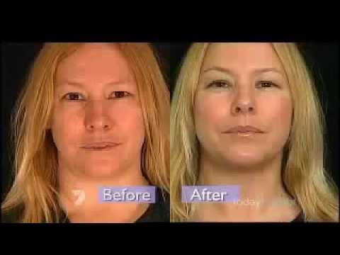 Diamond Health and Beauty Today Tonight Diamond Medilift - YouTube