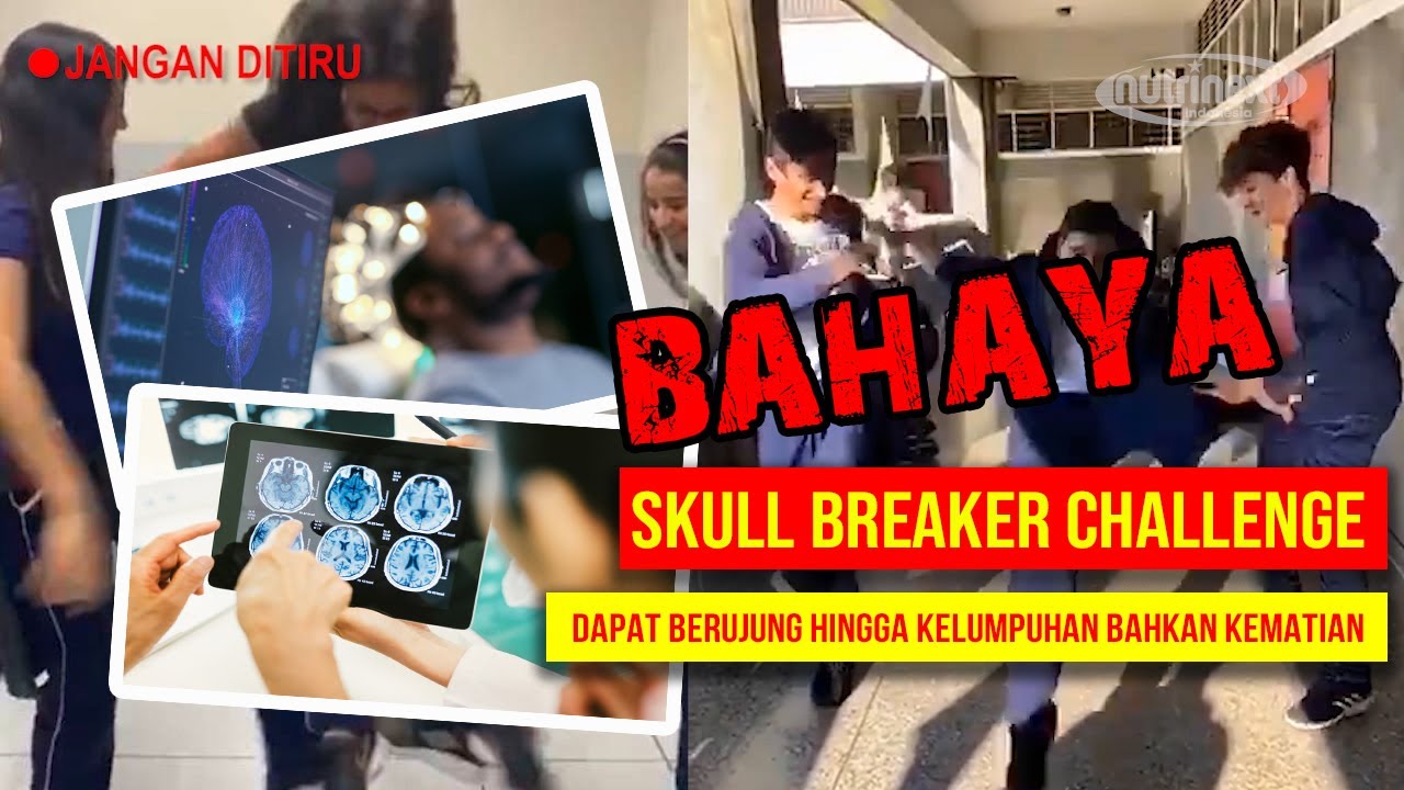 Fakta Bahaya Skull Breaker Challenge Tik Tok - YouTube