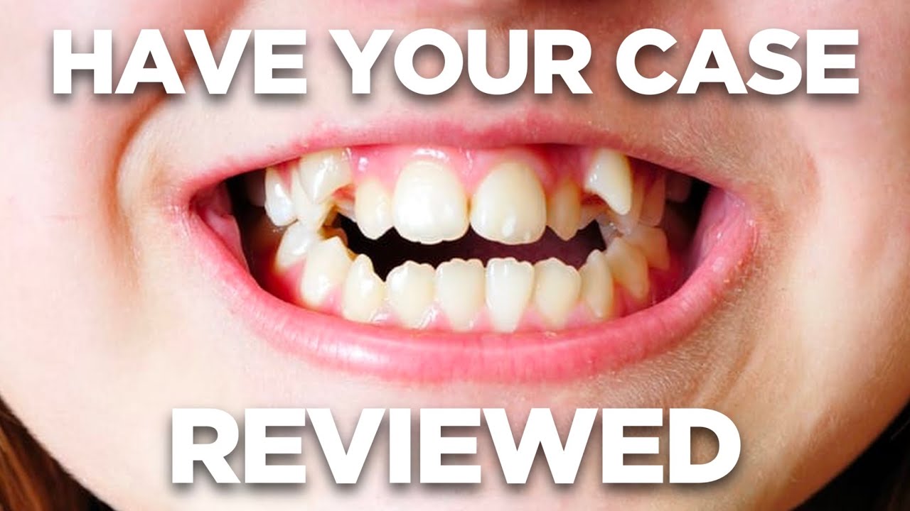 Have your case reviewed - YouTube
