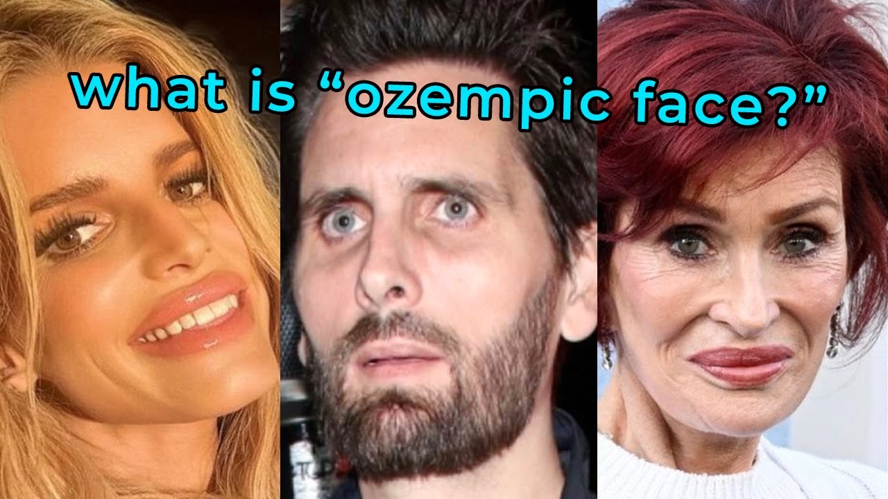 Celebrities Are Suffering From "Ozempic Face" - YouTube