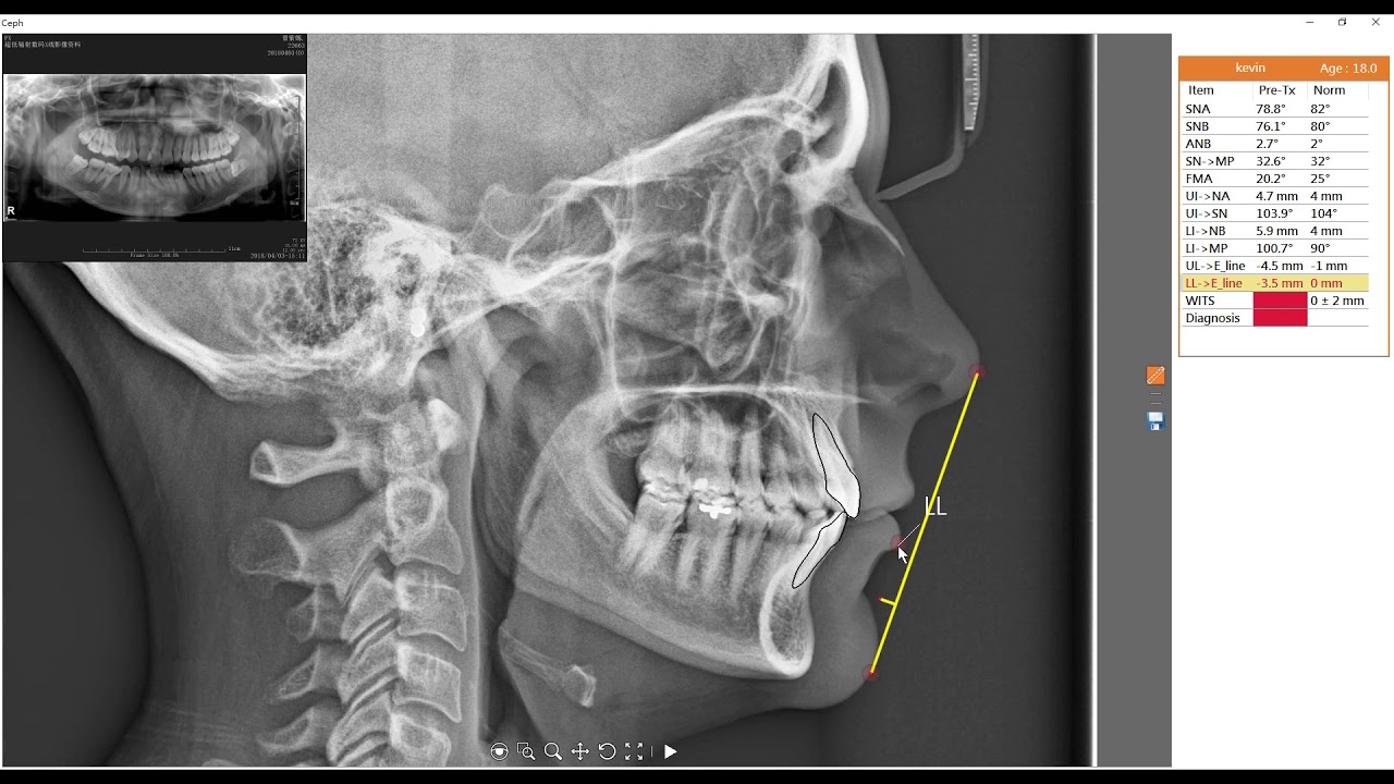 Ceph Tracing - YouTube