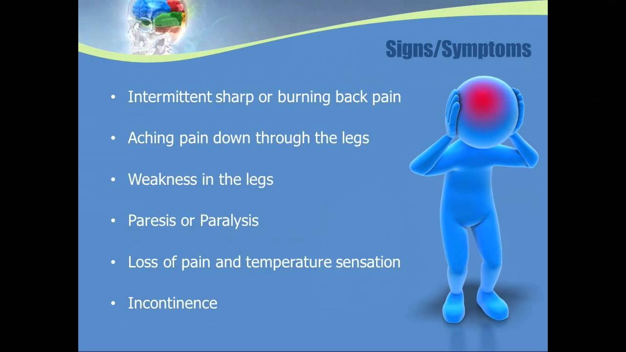 Spinal Cord Infarct - YouTube