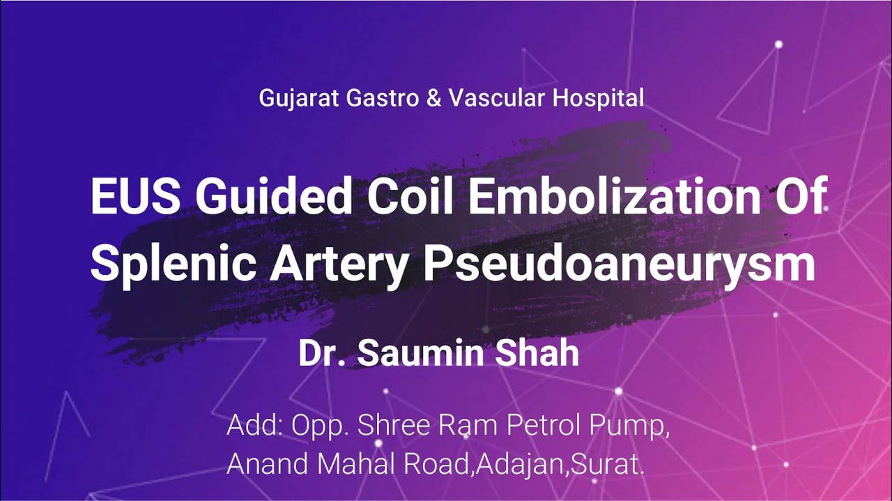 Coil Embolization Pseudoaneurysm At Madalyn Hartley Blog